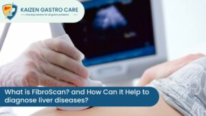 What is FibroScan Test? and How Can It Help to diagnose liver diseases ...
