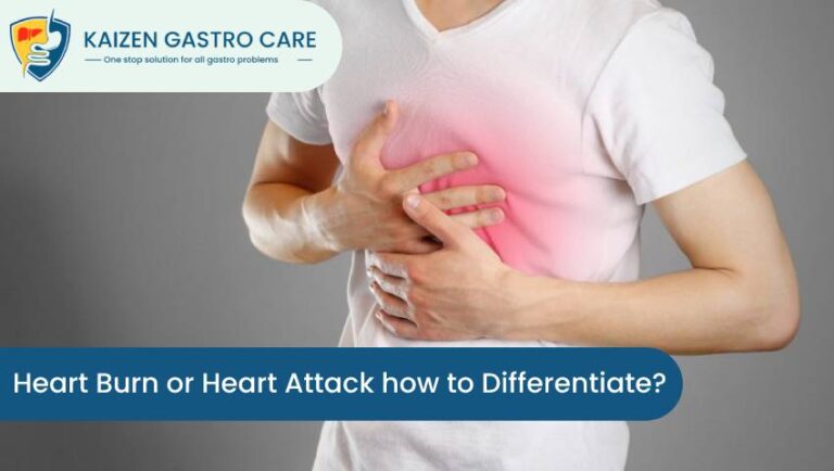 Heartburn vs Heart Attack how to Differentiate? | Kaizen Gastro Care