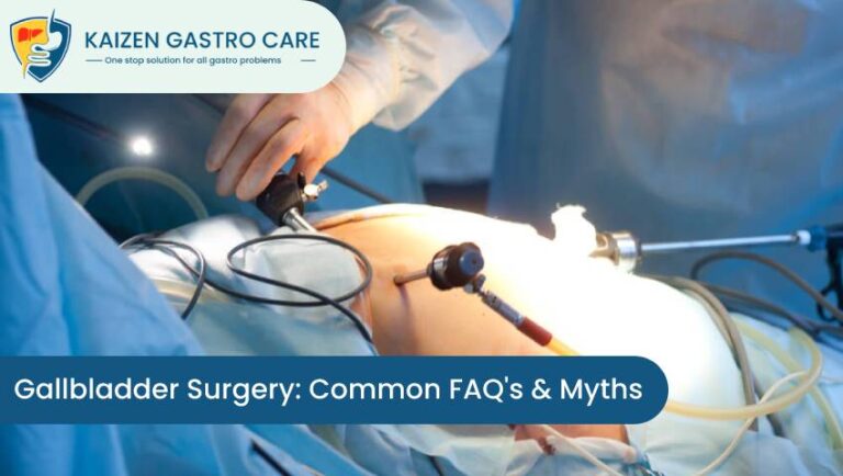 Gallbladder Surgery: Common FAQ’s and Myths- Kaizen Gastro Care