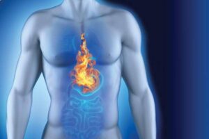 Acidity Specialist in Pune | Acidity Treatment in PCMC, Pune: Kaizen ...