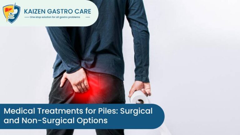 Medical Treatments for Piles: Surgical and Non-Surgical Options- Kaizen ...