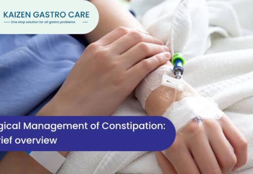 Surgical Management of Constipation: A brief overview- Kaizen Gastro Care