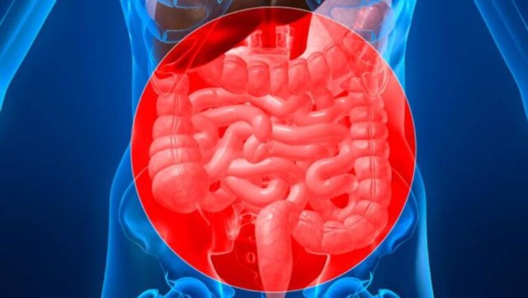 What to Do If You Experience Colon Pain: Essential Steps and Treatment ...