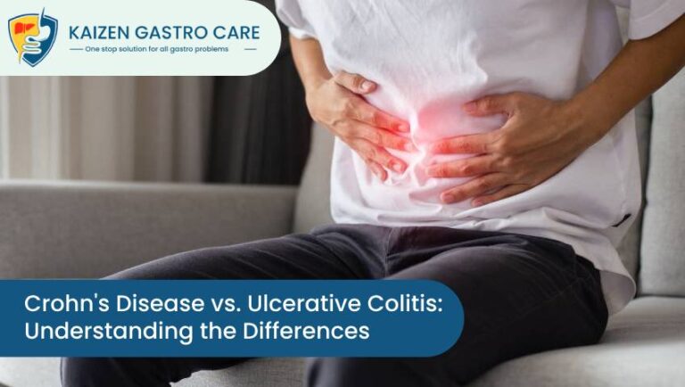 Crohn’s Disease vs. Ulcerative Colitis: Understanding the Differences- Kaizen Gastro Care
