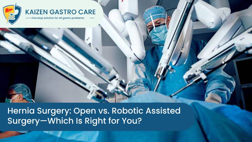 Hernia Surgery: Open vs. Robotic-Assisted Surgery—Which Is Right for You?