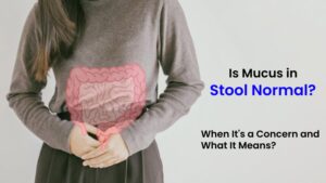 Is Mucus in Stool Normal? When It’s a Concern and What It Means?