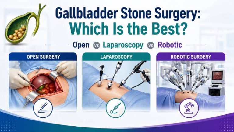 Gallbladder Stone Surgery: Open vs Laparoscopy vs Robotic | Kaizen ...